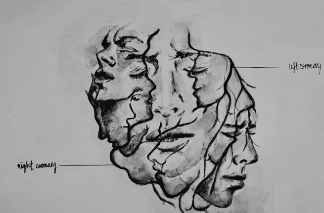 Drawing a picture of your diagnosis – Heart Sisters