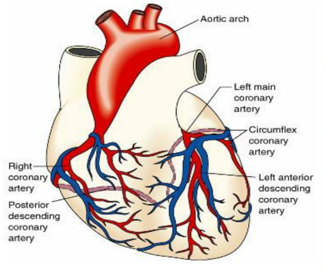 Revisiting the “widow maker” heart attack – Heart Sisters