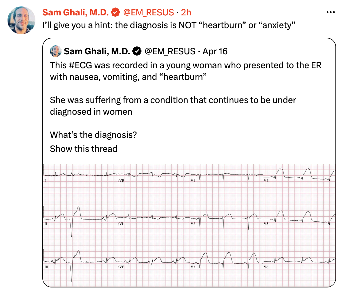 “I’ll give you a hint: the diagnosis is NOT heartburn or anxiety ...